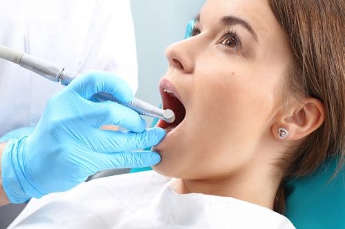 Root Canal vs. Filling: What’s the Difference?
